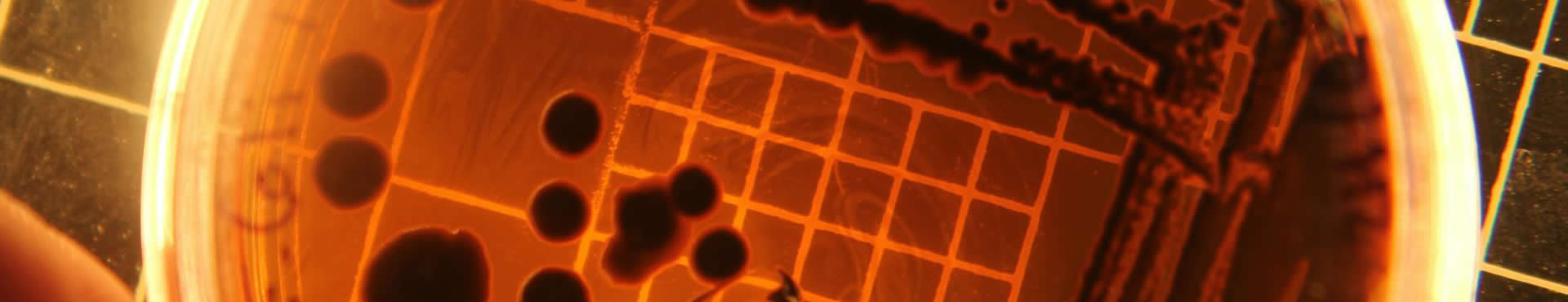 PDA Microbiology/Environmental Monitoring Interest Group Virtual ...