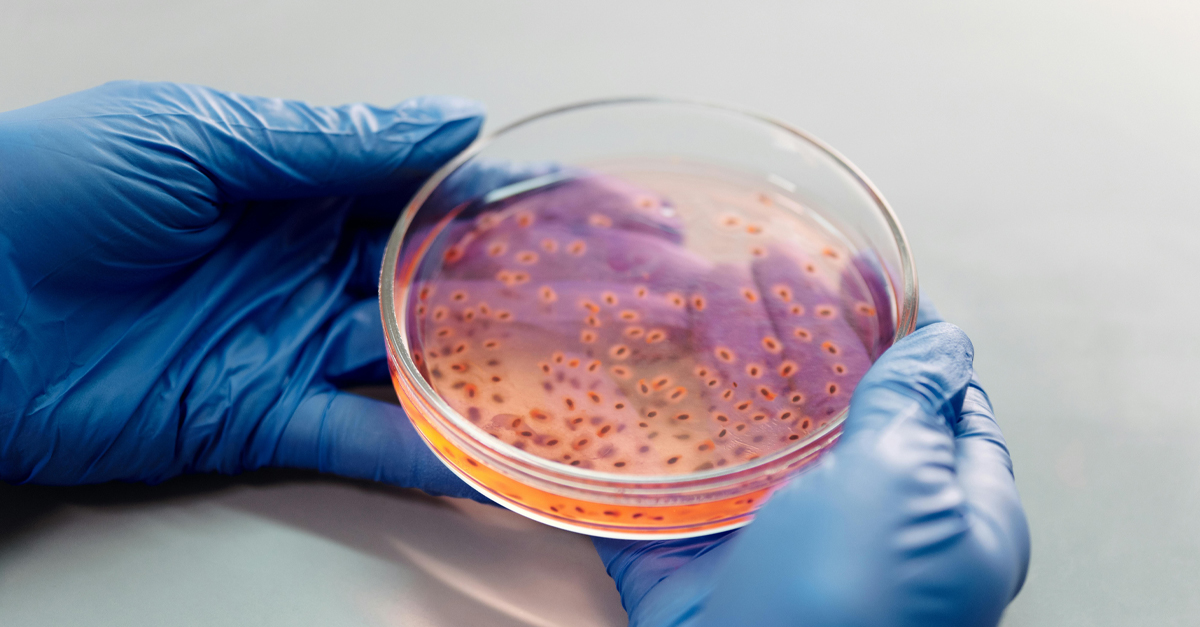 Facilitating Adoption of Modern Microbial Methods | PDA